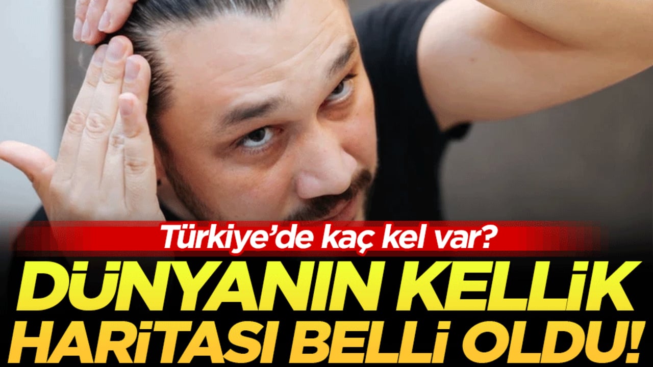Dünyanın kellik haritasi belli oldu! Türkiye'de kaç tane kel var ...