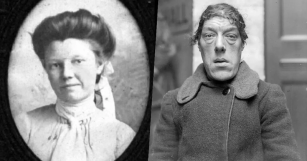 Bu kadın dünyanın en çirkin kadını seçildi! Görünce diliniz tutulacak ...