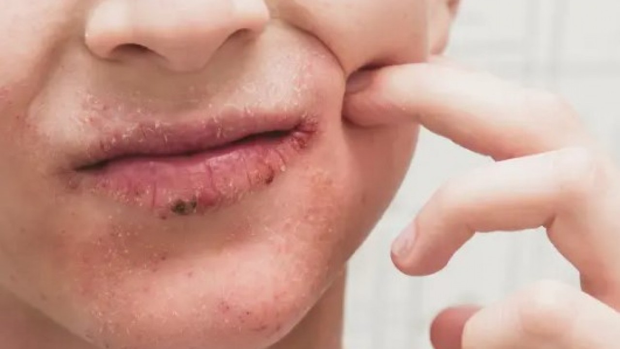 Erken tanı çok önemli: Bu işaretleri hafife almayın! - Yeni Akit