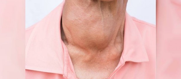 Tiroid nedir, tiroid hastalığının belirtileri nelerdir? - Yeni Akit