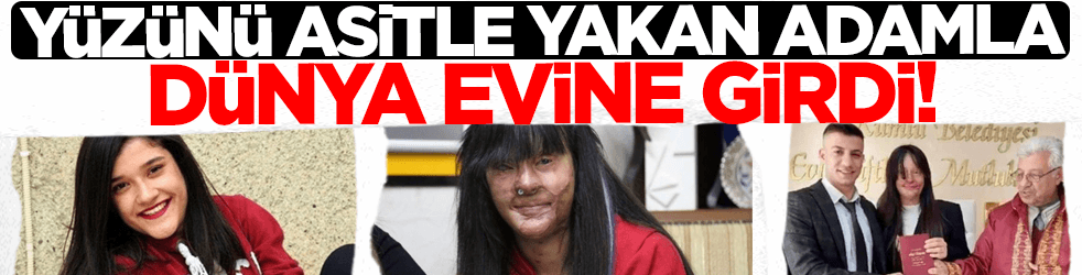 Berfin Özek yüzünü kezzapla yakan Ozan Çeltik ile evlendi - Yeni Akit