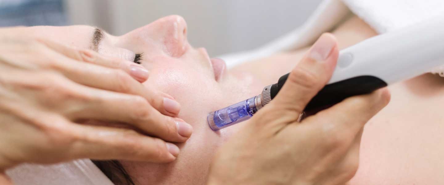 Mezoterapi nedir nasıl uygulanır? - Yeni Akit