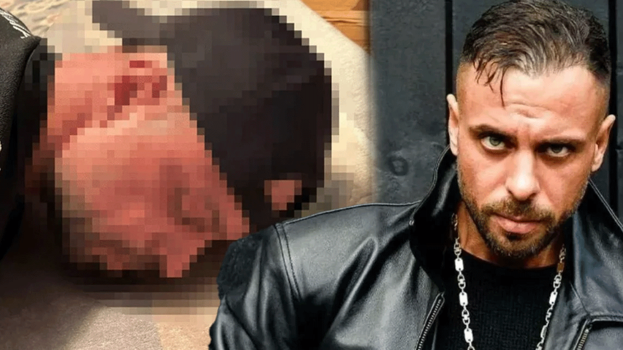 'Massaka' musakka oldu! - Yeni Akit